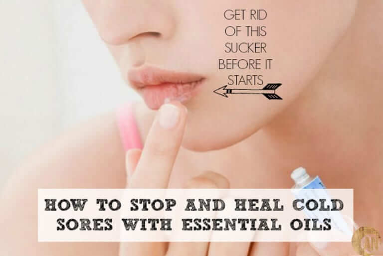 How To Stop And Heal Cold Sores With Essential Oils Ancestral Nutrition